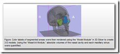 3D Slicer – Open Source Software for CT and MRI Radiology - Medical Quack